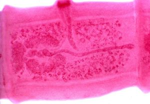 Taenia Tapeworms - Troccap