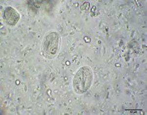 Giardia - Troccap